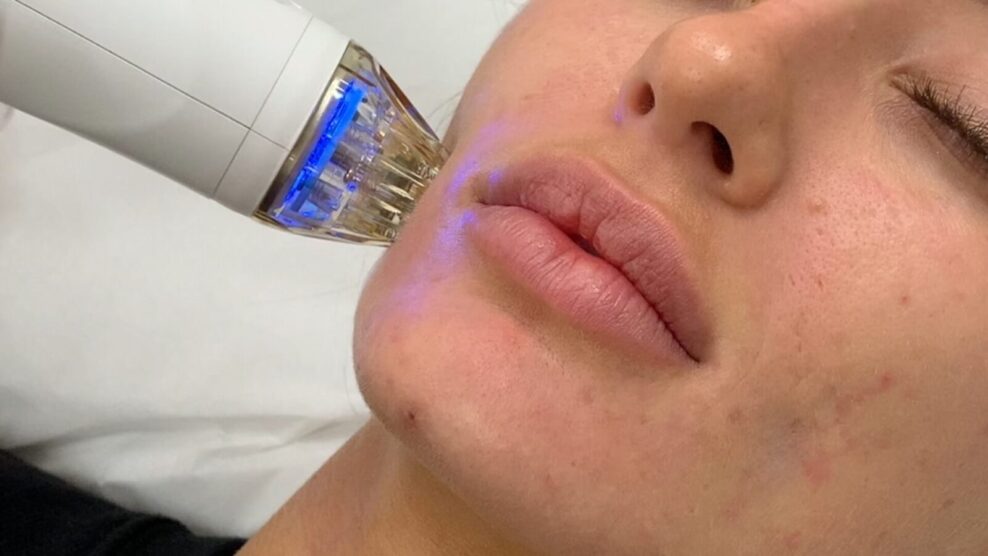 What Is PRP and Does It Work? - Oklahoma News